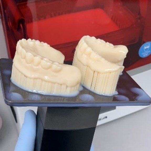 Digital Dentures in Stony Plain